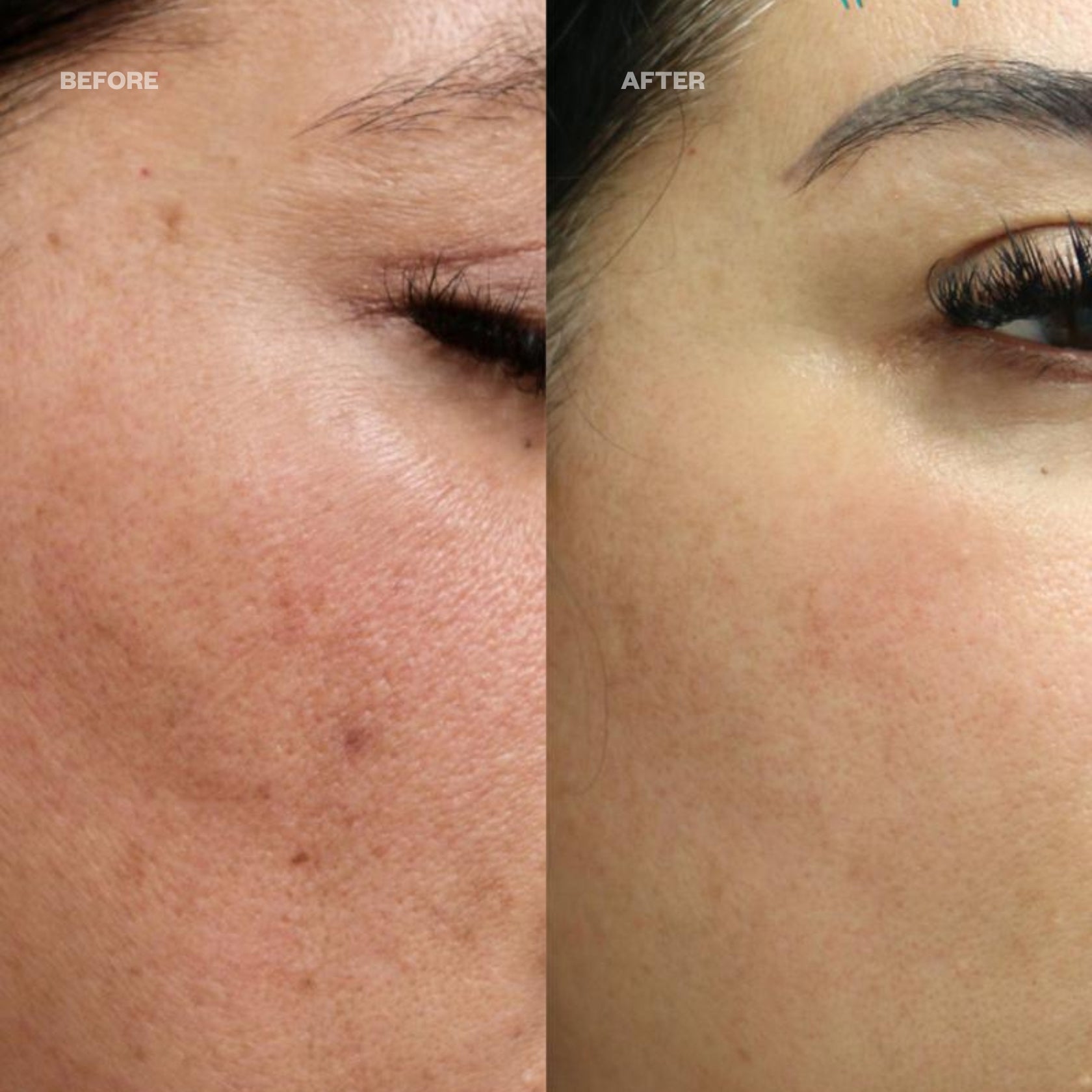 Anti Aging Lift + Renew Serum | Retinol & Bakuchiol - AziMD Skincare