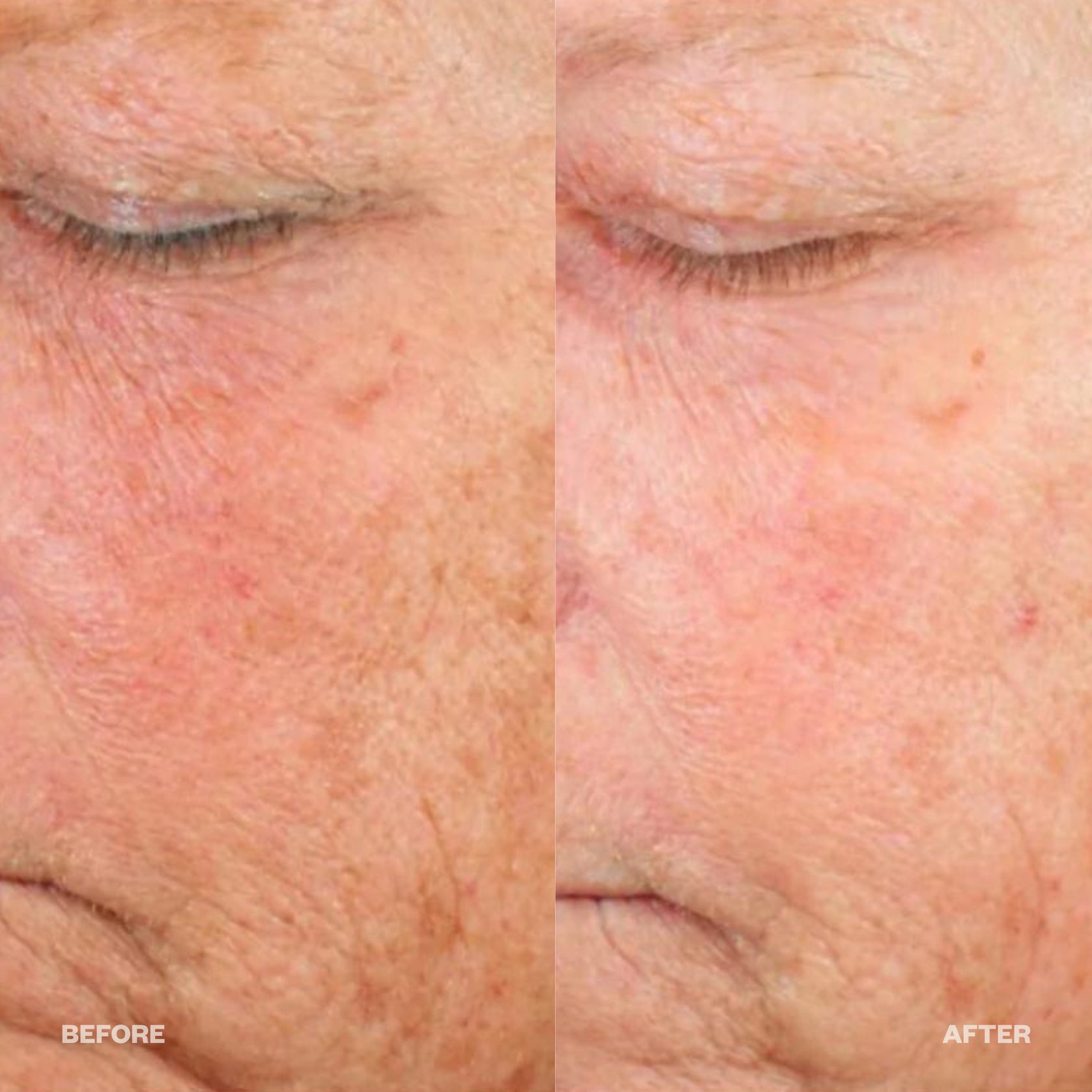 Anti Aging Lift + Renew Serum | Retinol & Bakuchiol - AziMD Skincare
